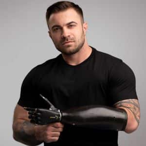 Chris Ruden: Disabled Model, Powerlifter & Motivational Speaker