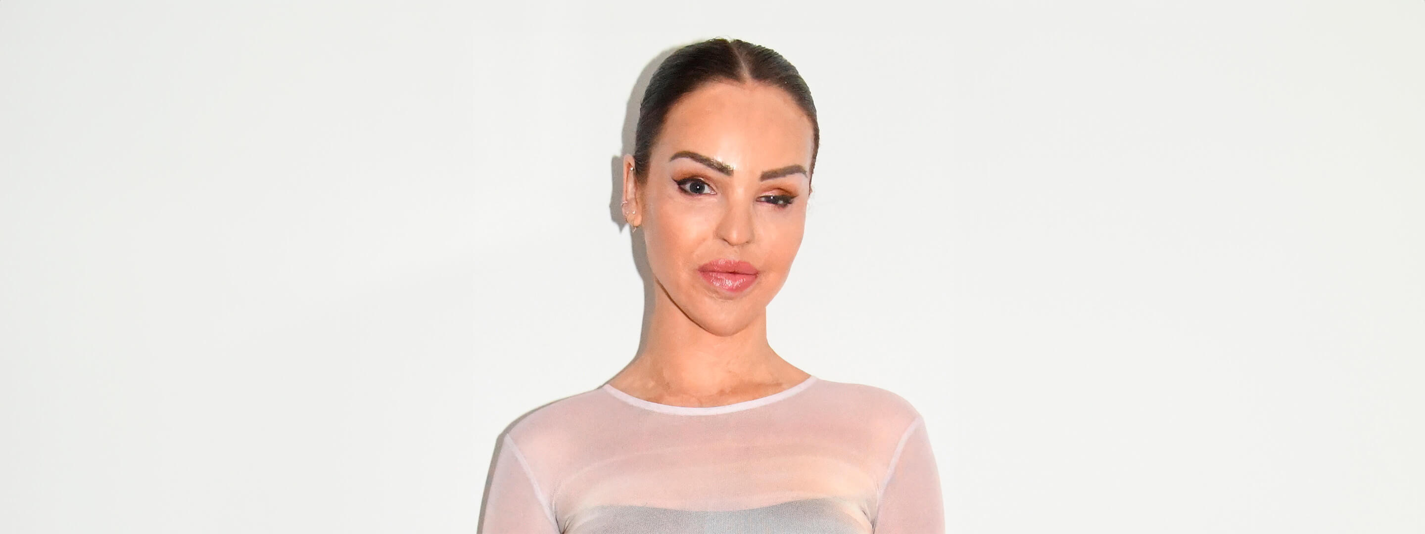 Katie Piper: Resilience and Empowerment Speaker